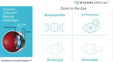 Visian Icl Orlando Implantable Collamer Lens Orlando Fl