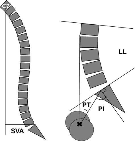 The Spinal Sagittal Alignment Measurements C7 Cervical 7 Sva Sagittal