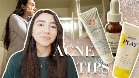 Skincare Routine 4 Tips For Acne Prone Skin Youtube