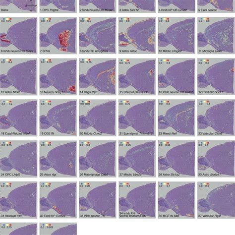 Spatial Transcriptomic Mapping Of Cell Type Clusters Spatial