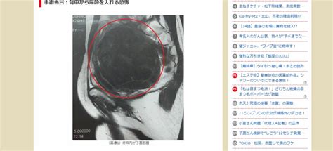 【子宮筋腫】腹腔鏡手術受けました。発覚から手術までの体験談です。 いとしろ堂