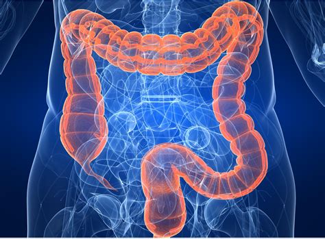 Colon Cancer Symptoms Stages Causes And Treatment 46 Off