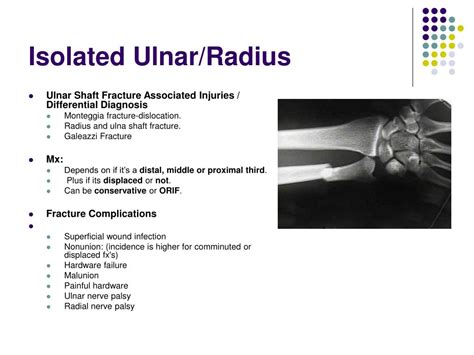 Ppt Forearm And Wrist Fractures Powerpoint Presentation Free
