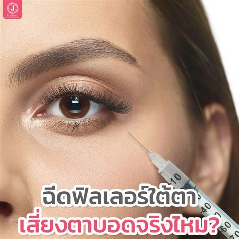 ฉีดฟิลเลอร์ใต้ตา เสี่ยงตาบอดจริงไหม เห็นผลดีแค่ไหนกัน J Young Clinic