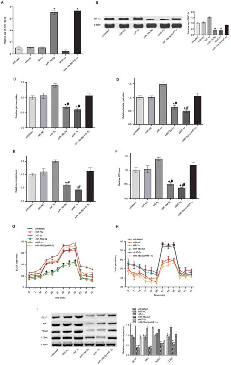 Microrna‑18a‑5p Regulates The Warburg Effect By Targeting Hypoxia