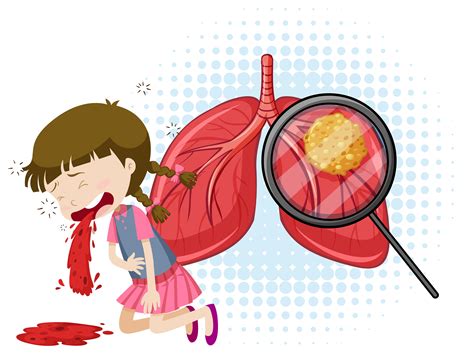 Tuberculosis Vectores Iconos Gráficos Y Fondos Para Descargar Gratis
