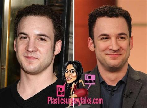 Ben Savage Nose Job Before And After Ben