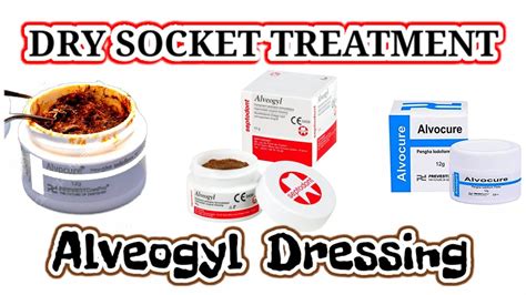 Dry Socket Paste