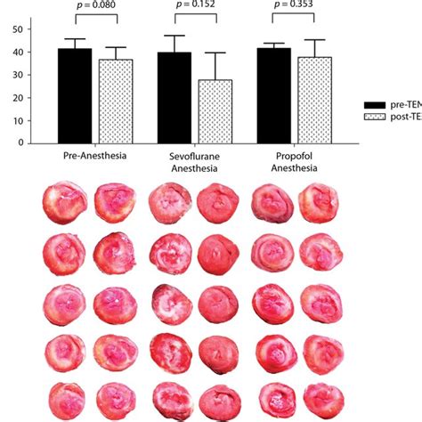 Comparisons Of Rat Myocardial Infarct Size Before And After Tens In