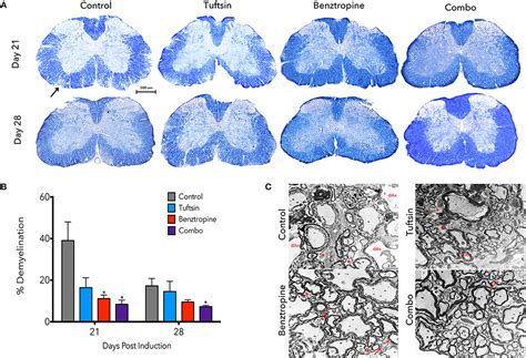 Frontiers Tuftsin Combines With Remyelinating Therapy And Improves