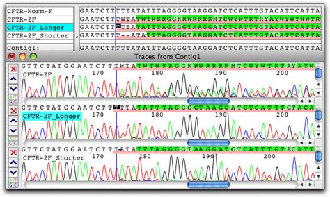 mutation detection with codoncode aligner find snps analyze