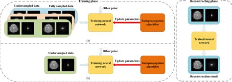 flowchart of deep learning for mri reconstruction with fully sampled