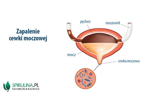 Zapalenie Cewki Moczowej Algi Spirulina I Chlorella