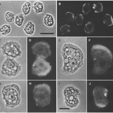 Fluorescence And Phase Contrast Micrographs Of Acanthamoeba Stained