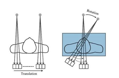 Generation Of Ct Computed Tomography Scanners — Matlab Number One