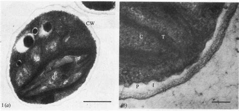 Electron Micrographs Showing An Intact Vegetative Cell Of C