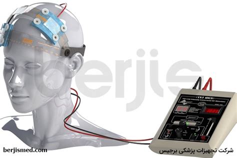 تحریک الکتریکی مغز با روش Tdcs شرکت تجهیزات پزشکی برجیس