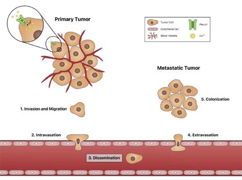 Metastasis Diagram