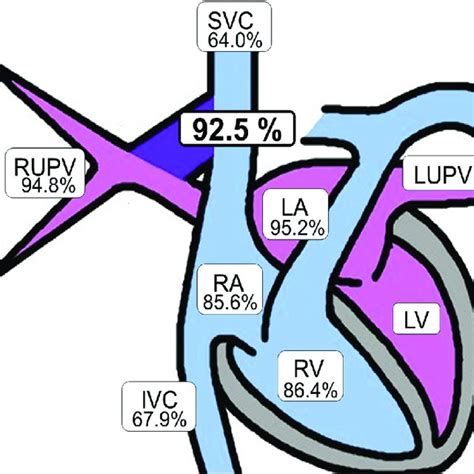 Oxygen Saturation Of Cardiac Catheterization The Oxygen Saturation