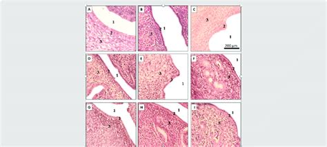Effects On Uterine Epithelium Uterine Epithelia Of Representative