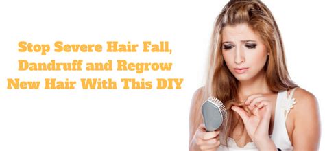Stop Severe Hair Fall Dandruff And Regrow New Hair With This Diy