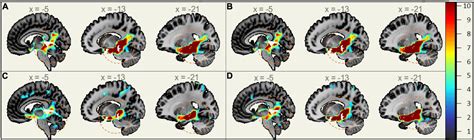 Frontiers Sex Differences In Brain Functional Connectivity Of
