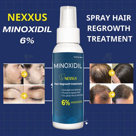 Nexxus Minoxidil Strands 6 Minoxidil Topical Solution 60ml Per Bottle