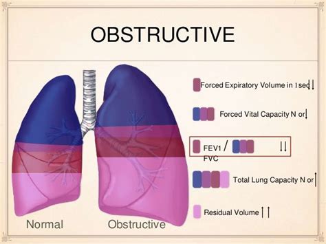 Shenfield Lung Function Assessment By Impulse Oscillometry 53 Off