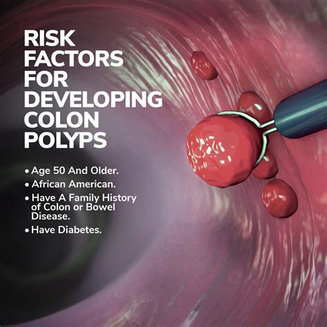 What Are Polyps Gastroenterology Of Greater Orlando