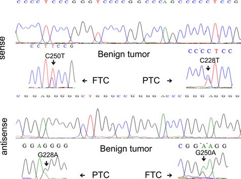 Representative Electropherograms Of The Two Tert Promoter Mutations