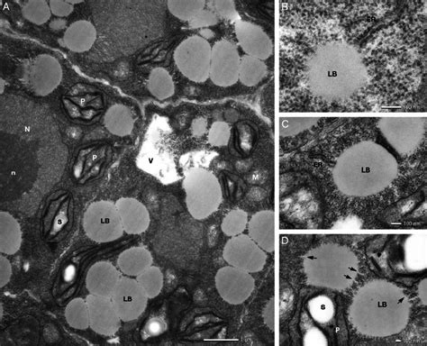 Electron Micrographs Of A Ultrathin Section Through A Wild Type