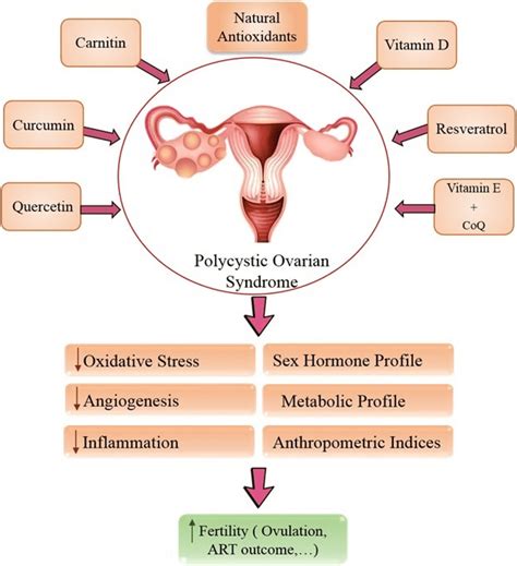 Natural Antioxidants May Improve Pcos Patients Fertility By Reducing