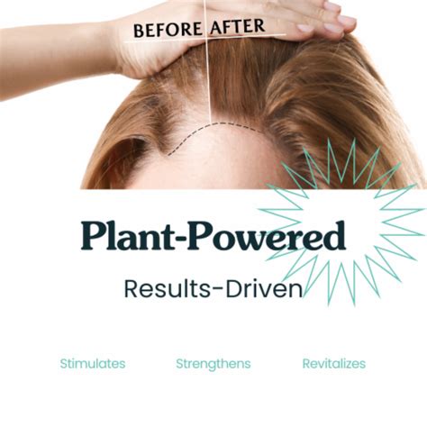 Clearly Gain Hair Growth Oil And Hair Loss Treatment With Garlic 2