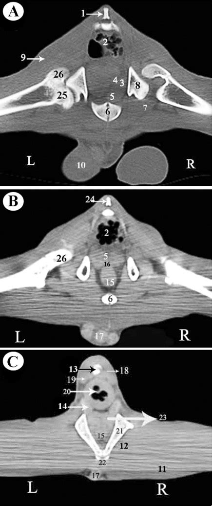 Morphological Examination Of The Accessory Sex Glands Of The Barki