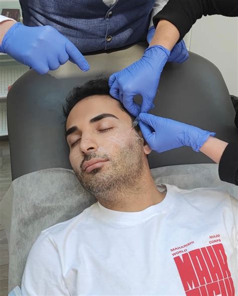 The Most Popular Aesthetic Treatments For Men Skinoza Academy