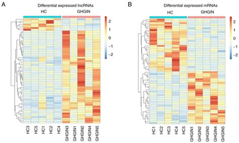 Long Non‑coding Rna Profiles In Plasma Exosomes Of Patients With