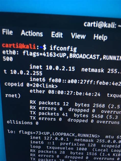 static ip configuration for kali linux oracle vm kalilinux