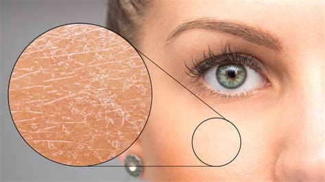 What Causes Dry Skin And How To Get Rid Of It Mamabella