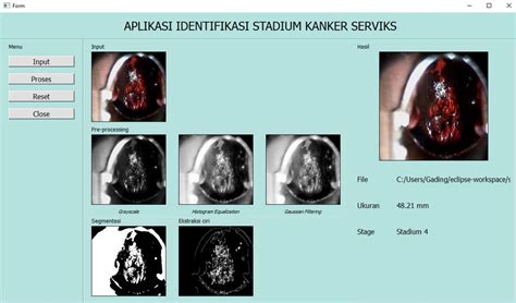 training pelatihan kursus jasa python membuat aplikasi deteksi kanker