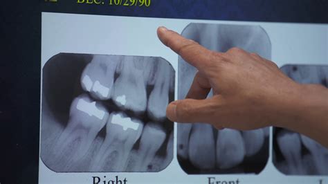 Unsolved Northwest How Wsp Uses Forensic Dental Records Testing To