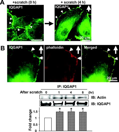Iqgap1 Regulates Reactive Oxygen Species Dependent Endothelial Cell