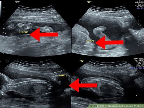 how to read an ultrasound picture 9 steps with pictures