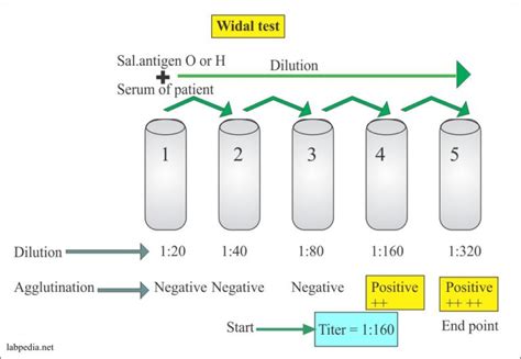 Enteric Fever Part 3 Typhoid Enteric Fever Diagnosis Widal Test