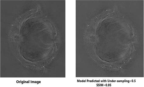 frontiers a deep learning approach for the photoacoustic tomography