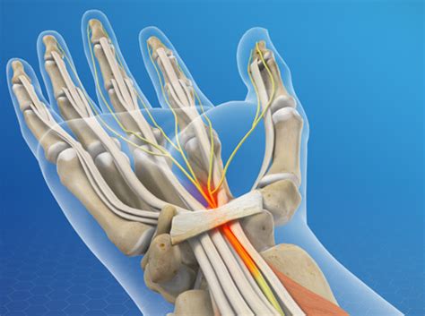 Video Carpal Tunnel Release Open Technique Healthclips Online