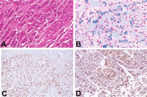 Histopathology And Immunohistochemistry Ihc Stains Of Human