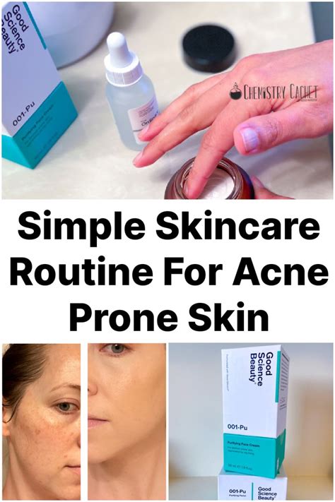 Simple Skincare Routine For Acne Prone Skin