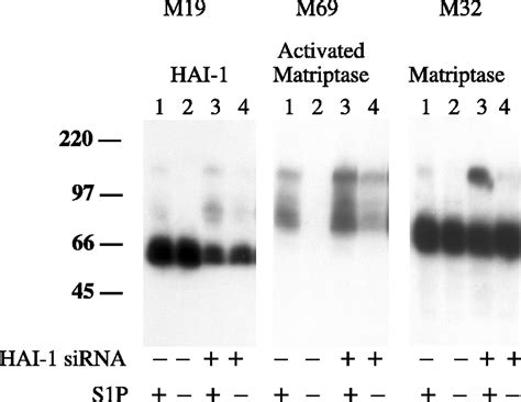 Hai 1 Regulates Activation And Expression Of Matriptase A Membrane
