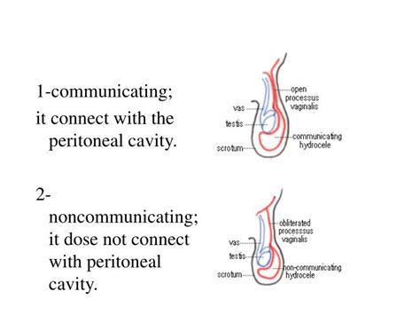 Ppt Scrotal Swelling Powerpoint Presentation Id 6841092