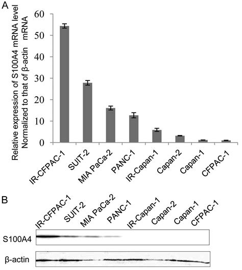 S100a4 Mrna Expression Level Is A Predictor Of Radioresistance Of